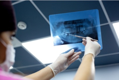 ทันตกรรมรักษารากฟัน ด้วยมืออาชีพ | Dentplease Clinic